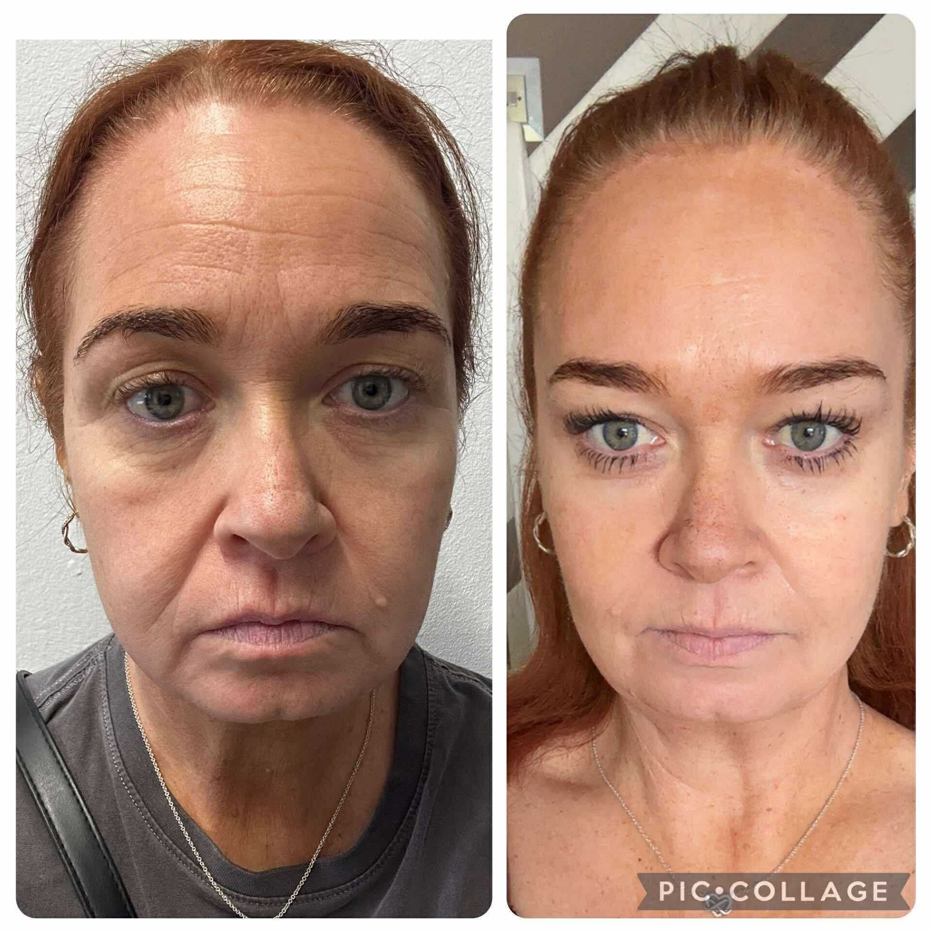 Sculpt Aesthetics And Laser Clinic | Lisa Cantelo